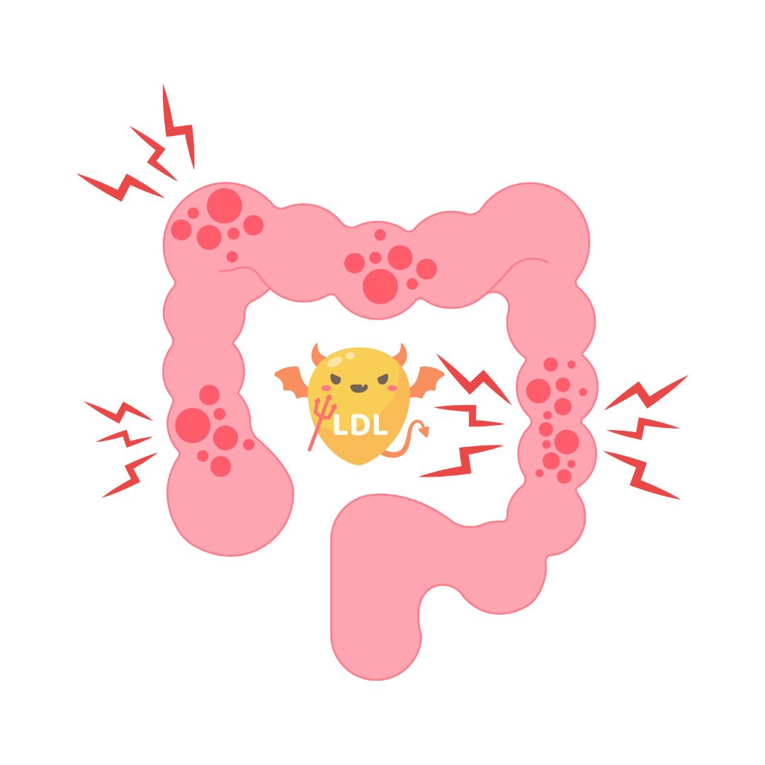 Inflammation and Cholesterol: 3 Tips to Lower Cholesterol that Start in ...